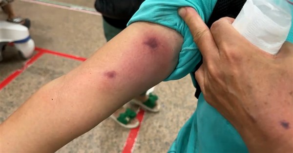 5 more hikers attacked by hornets in New Taipei's Ruifang - Focus Taiwan